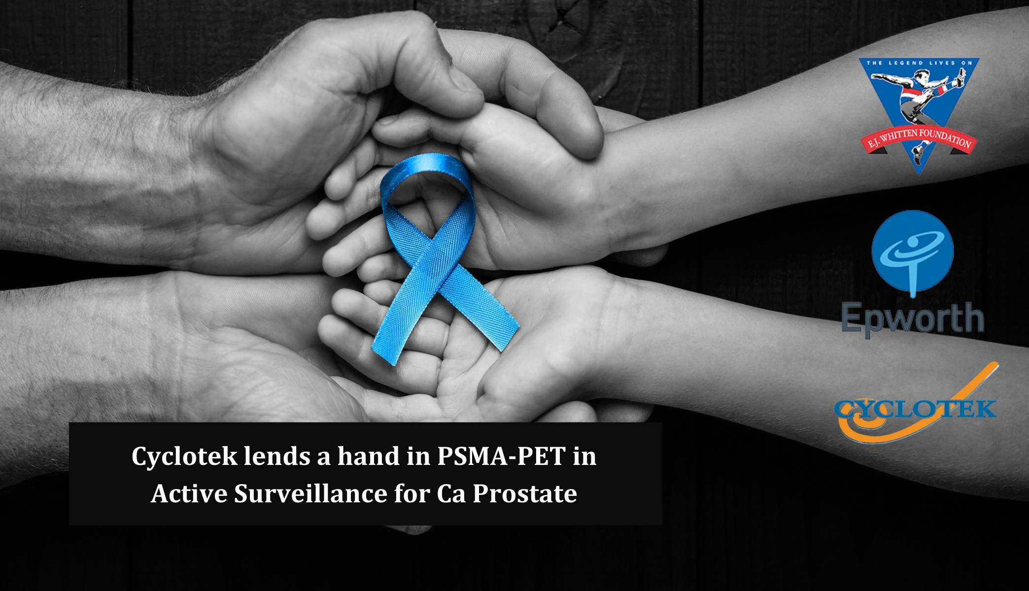 Cyclotek lends a hand in PSMA-PET in Active Surveillance for Ca ...